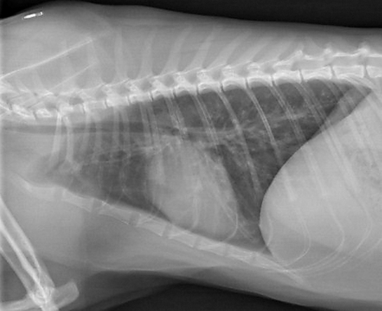 Top 5 Indications for Emergency Corticosteroid Therapy | Clinician's Brief