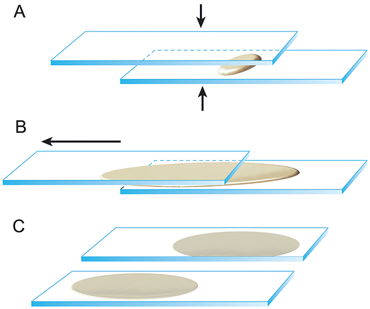 Cytology from Fine-Needle Aspirates | Clinician's Brief