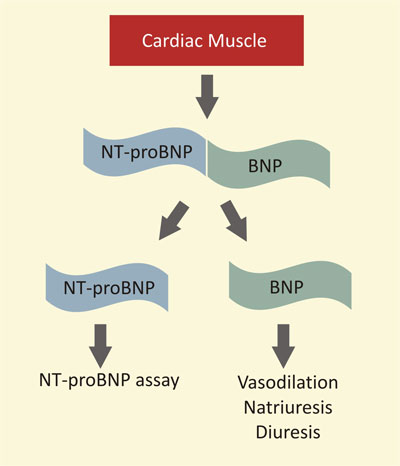 Cardiac N-Terminal Pro–B-Type Natriuretic Peptide Assay | Clinician's Brief