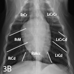 Canine Thoracic Radiograph