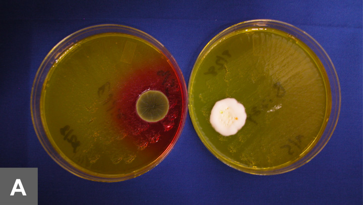 Microscopic Examination of Fungal Cultures | Clinician's Brief