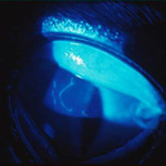 Herpetic Keratoconjunctivitis in a Cat | Clinician's Brief