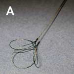 Caval Syndrome | Clinician's Brief