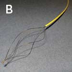 Caval Syndrome | Clinician's Brief