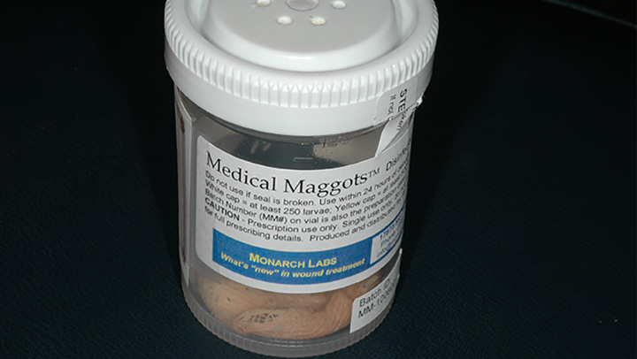 A Fly in My Ointment: Maggot Therapy | Clinician's Brief