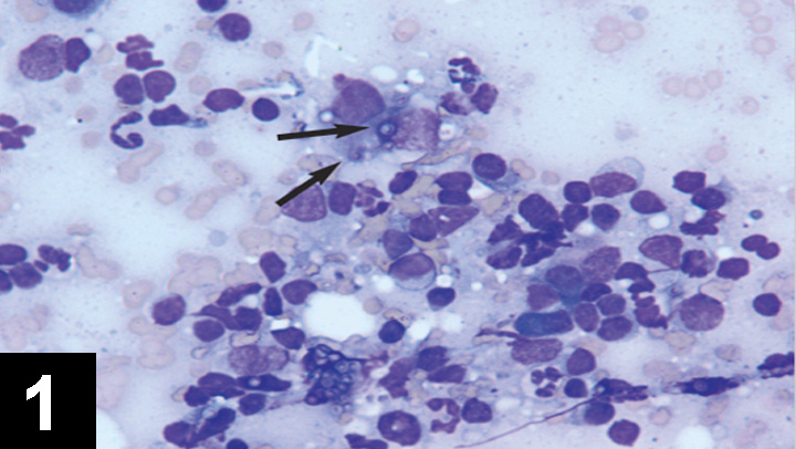 Lymph Node Cytology Clinician S Brief