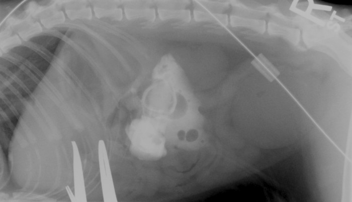 Percutaneously Placed Gastrostomy Tubes: Prevention and Treatment ...