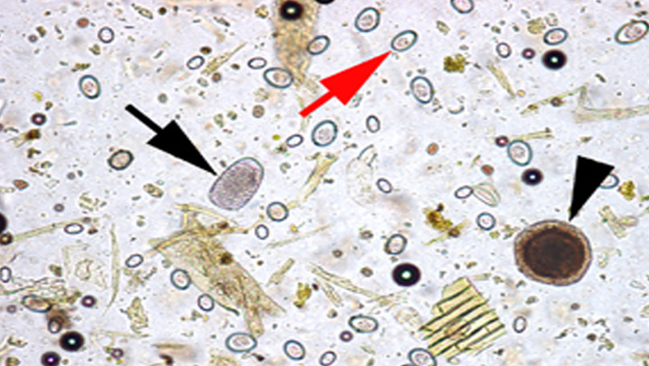 Fecal Sample Analysis | Clinician's Brief