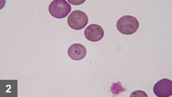 Diagnosing & Treating Babesiosis in Dogs | Clinician's Brief