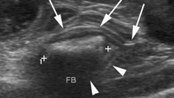 To Cut or Not To Cut: Foreign Body in a Cat? | Clinician's Brief