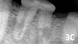 Tooth Resorption in Dogs | Clinician's Brief