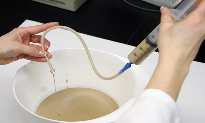 Enteral Nutrition: Step-by-Step | Clinician's Brief