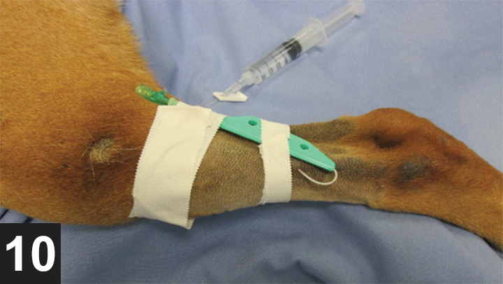Placing a Central Sampling Catheter Through a Peripheral Vein ...