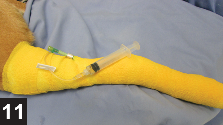 Placing a Central Sampling Catheter Through a Peripheral Vein ...