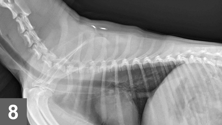 Central Venous Catheter Placement: Modified Seldinger Technique ...