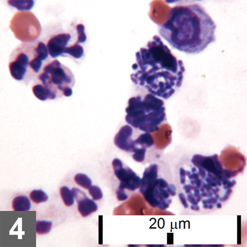 Transitional Epithelial Cells
