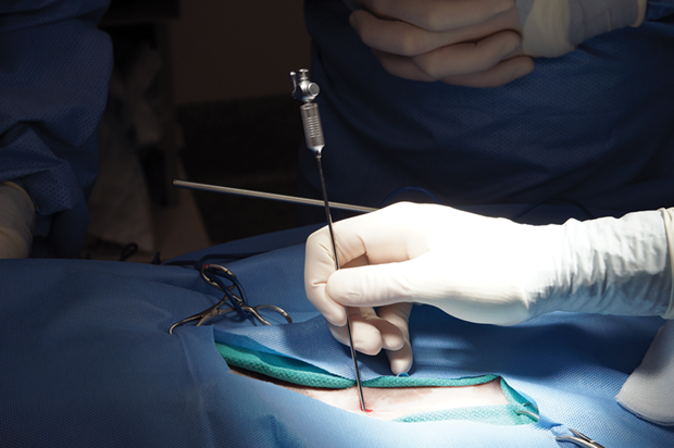 Pancreatic Biopsy | Clinician's Brief