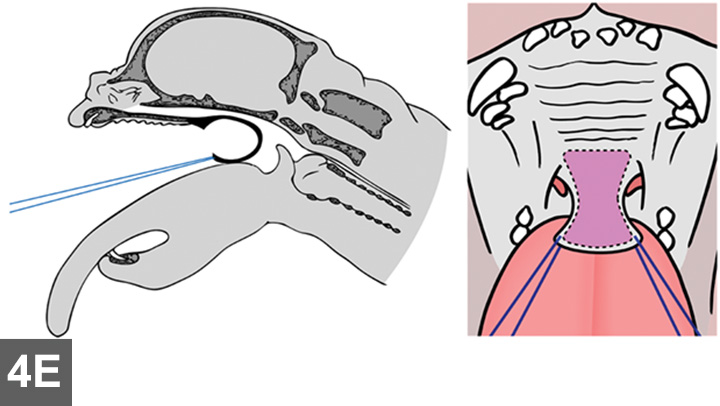 Brachycephalic Syndrome: Innovative Surgical Techniques | Clinician's Brief