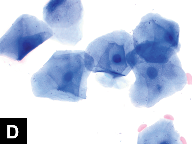 Determining Canine Estrus Stage via Vaginal Cytology | Clinician's Brief