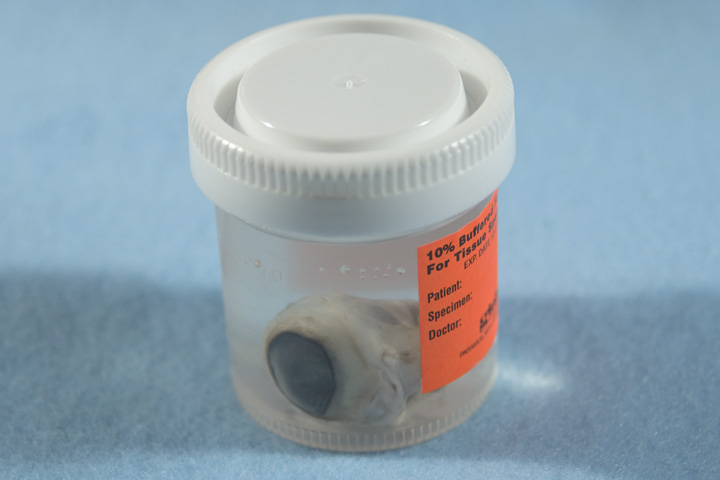 Subconjunctival Enucleation Surgery in Dogs & Cats | Clinician's Brief