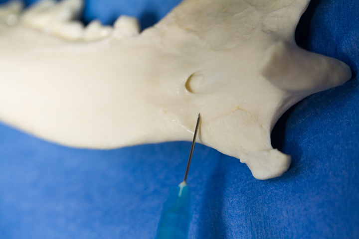 Nerve Blocks for Oral Surgery in Dogs | Clinician's Brief