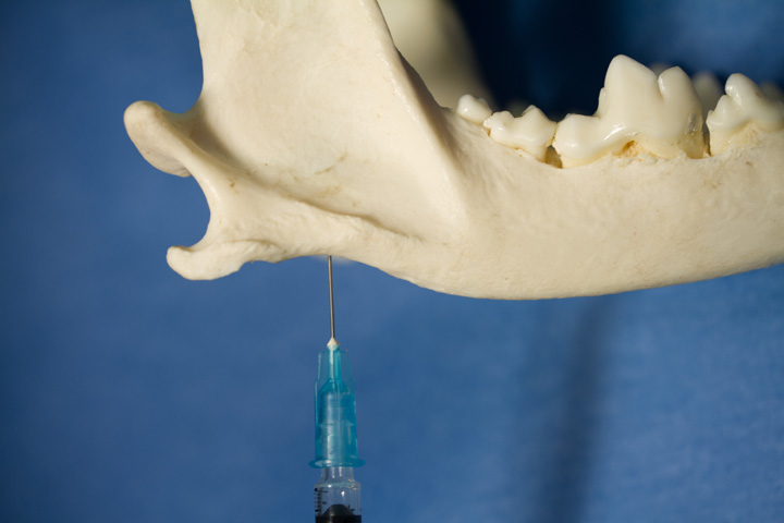Nerve Blocks for Oral Surgery in Dogs | Clinician's Brief