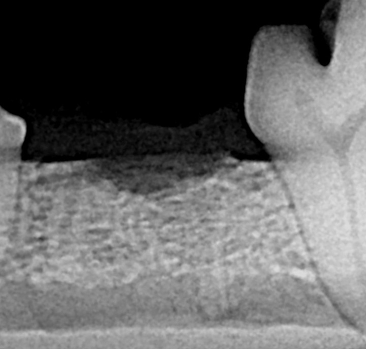 Treating Tooth Resorption in Dogs | Clinician's Brief