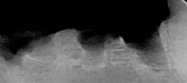 Treating Tooth Resorption in Dogs | Clinician's Brief