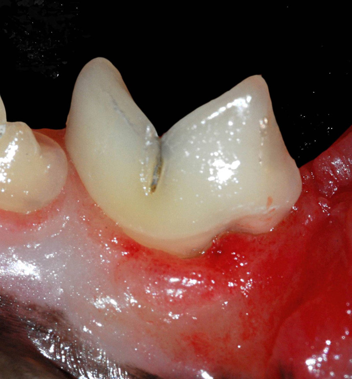 Feline Oropharyngeal Inflammation | Clinician's Brief