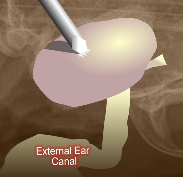 Surgical Removal of Feline Inflammatory Polyps | Clinician's Brief