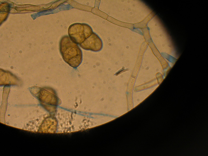 Microscopic Examination of Fungal Cultures | Clinician's Brief