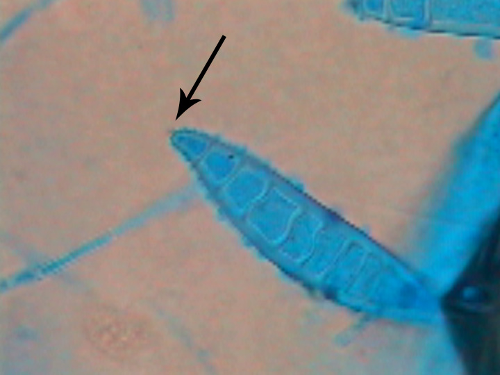 Microscopic Examination of Fungal Cultures | Clinician's Brief