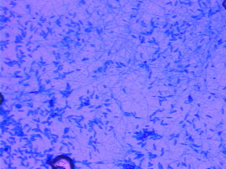 Microscopic Examination of Fungal Cultures | Clinician's Brief