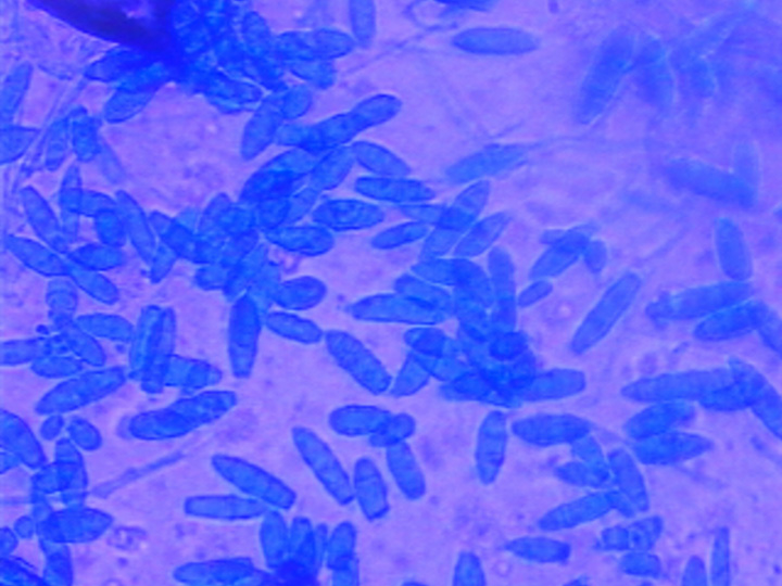Microscopic Examination of Fungal Cultures | Clinician's Brief