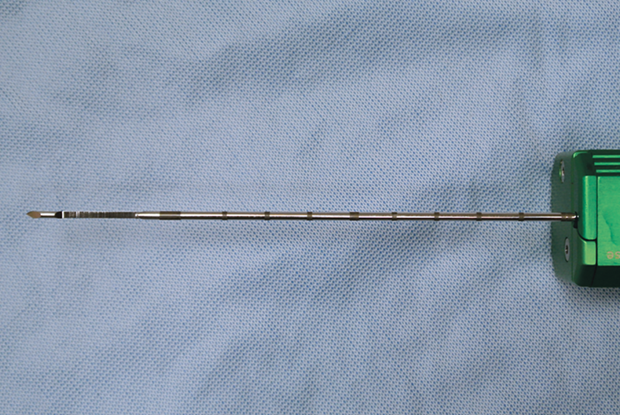 Ultrasound-Guided Biopsy of the Liver | Clinician's Brief