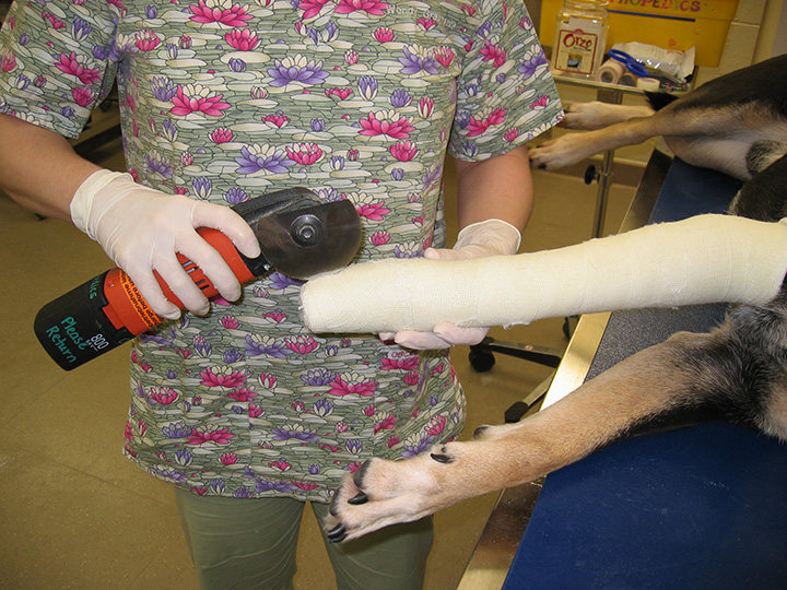 Effective Casting Techniques | Clinician's Brief