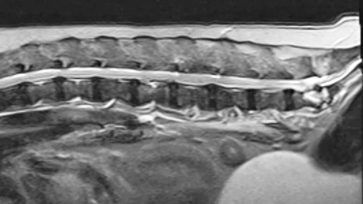 Treatment of Lumbosacral Disease | Clinician's Brief
