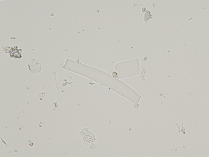 Skills for Technicians: Urine Sample Collection & Analysis | Clinician ...