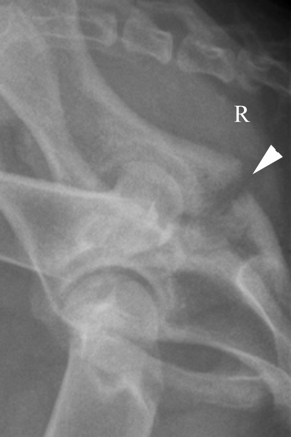 Tips & Techniques for Pelvic Radiography | Clinician's Brief