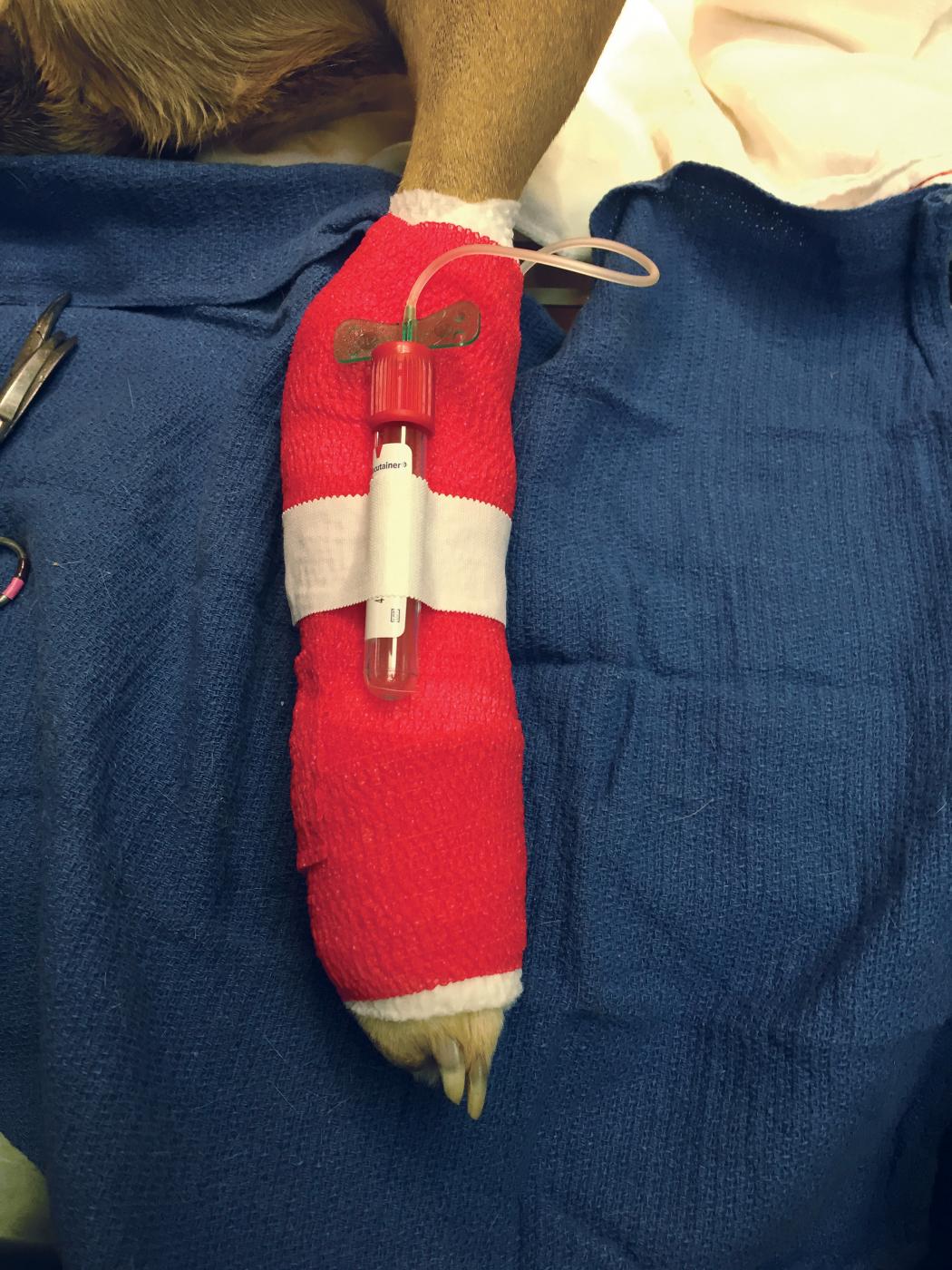 Surgical Drains for Wound Management | Clinician's Brief