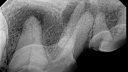 How to Interpret Dental Radiographs | Clinician's Brief
