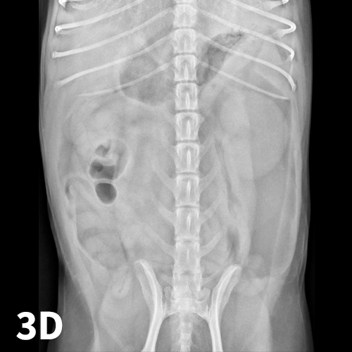 Top 5 Tips on Radiographic Diagnosis of Obstructive Foreign Bodies ...