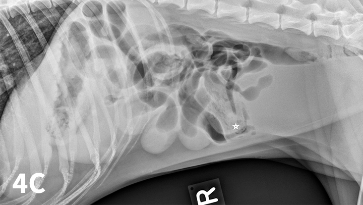 Top 5 Tips on Radiographic Diagnosis of Obstructive Foreign Bodies ...