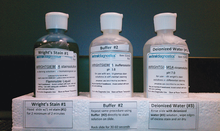 Urine Sediment Evaluation | Clinician's Brief