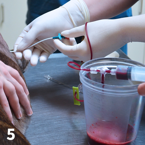 Pericardiocentesis | Clinician's Brief