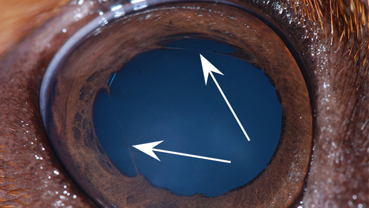 Image Gallery: Anisocoria | Clinician's Brief