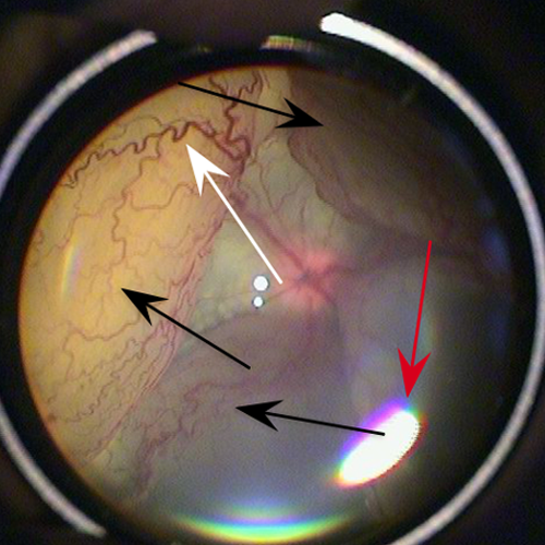 Image Gallery: Canine Fundus Diseases | Clinician's Brief