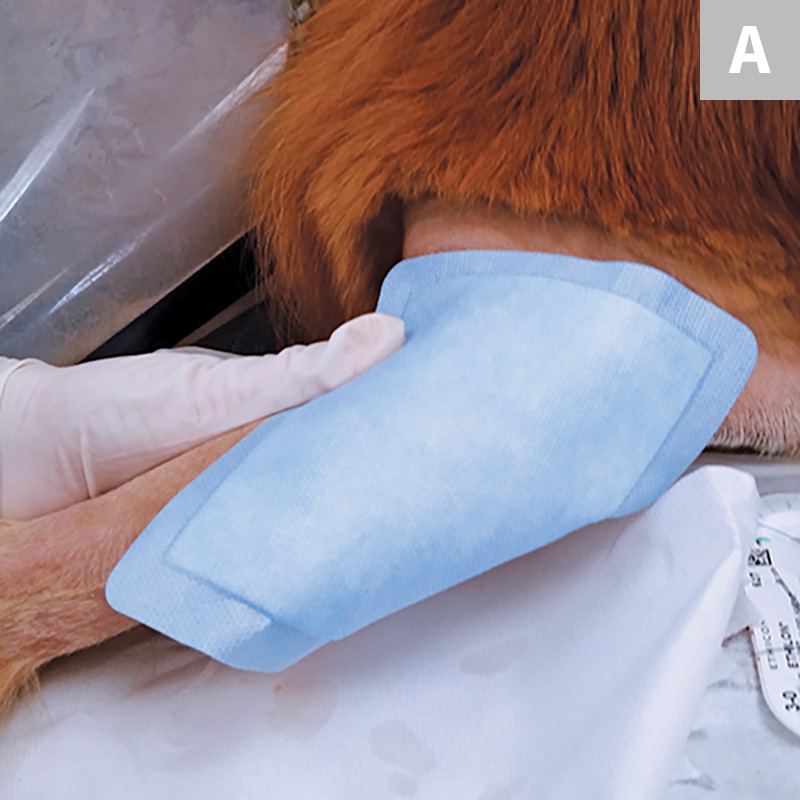 Tensioning Sutures for Open Wounds | Clinician's Brief