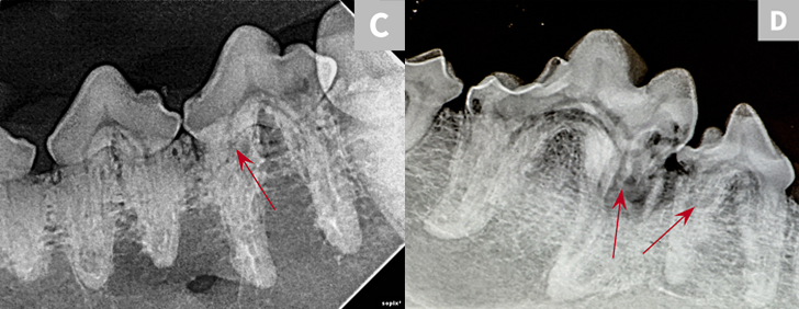 Image Gallery: Dental Radiography | Clinician's Brief