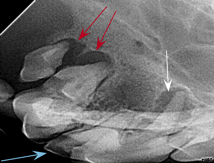 Image Gallery: Dental Radiography | Clinician's Brief